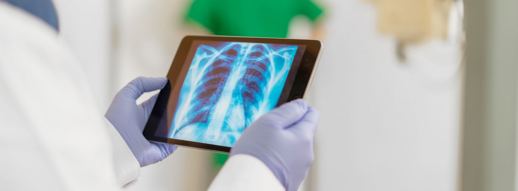 Rontgen Thorax